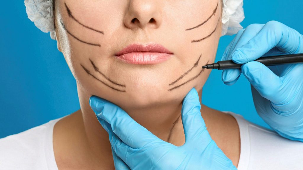 facial-surgery-gallery – Santa Fe Plastic Surgery Center